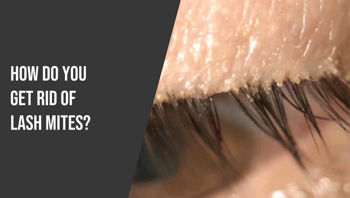 How Do You Get Rid of Lash Mites? | The Lash Professional