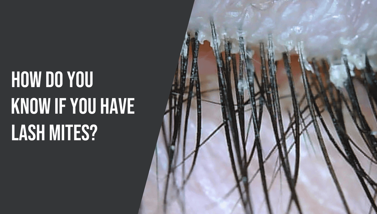How Do You Know If You Have Lash Mites? | The Lash Professional