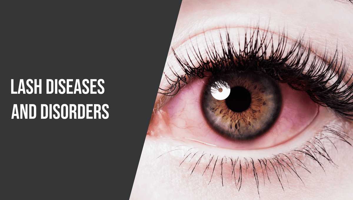 Lash Diseases and Disorders - The Lash Professional